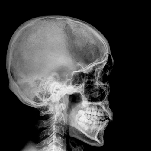 Képalkotó eljárások - Fájdalomközpont